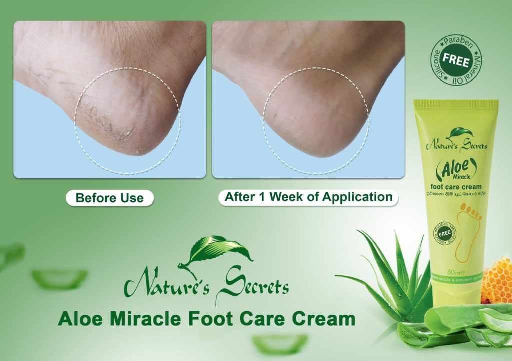 Kem Dưỡng Gót Chân Aloe Foot Care Cream 80ml - NBC Solutions